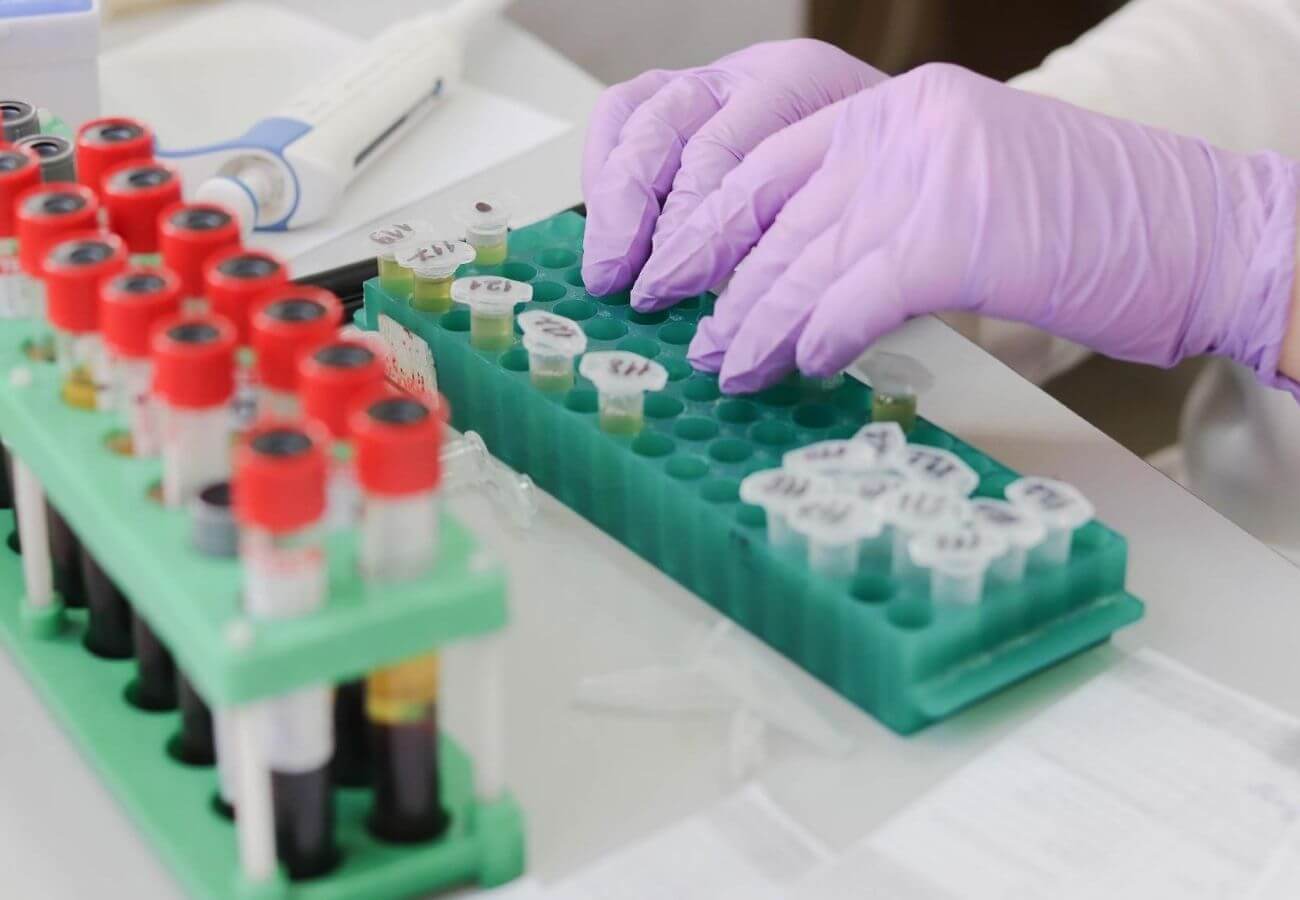 Importancia del testeo para volver seguro al trabajo